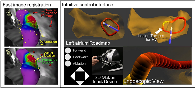 MRI-guided Navigation – IRIS