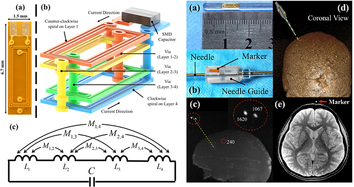 MRI-guided Navigation – IRIS